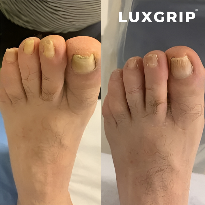 LuxGrip® - The Ultra Sharp Luxurious German Nail Clipper